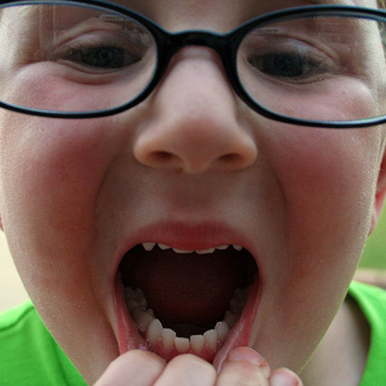 Loose Tooth Game Plan - Dr. John Cherry, Jr., DMD
